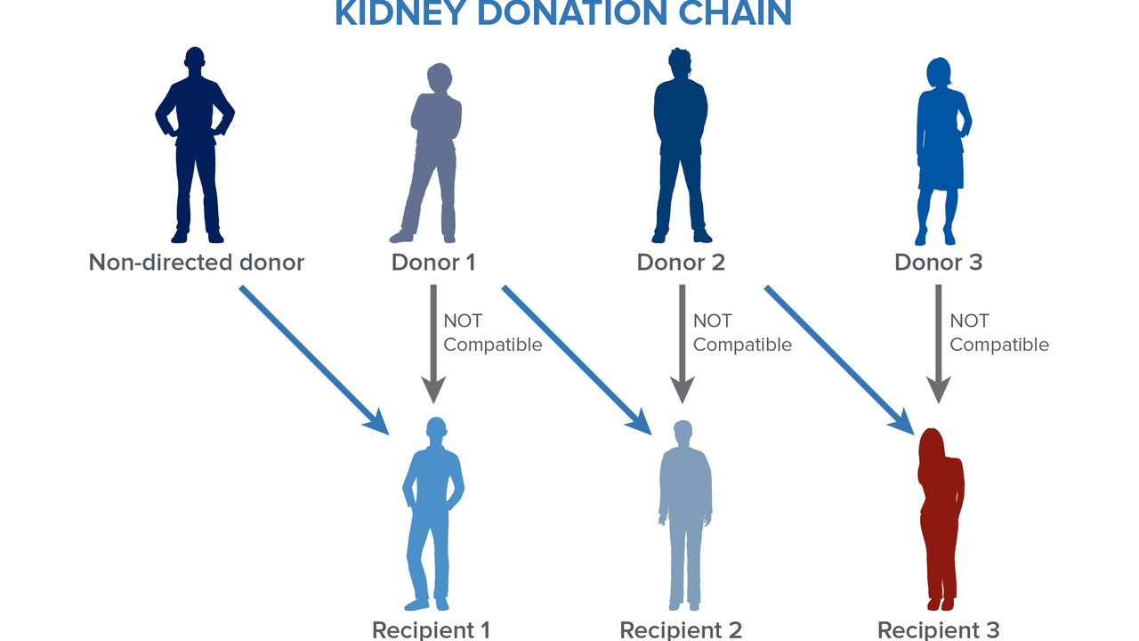 Kidney transplantation: End-chain kidney paired donation | Clinical ...