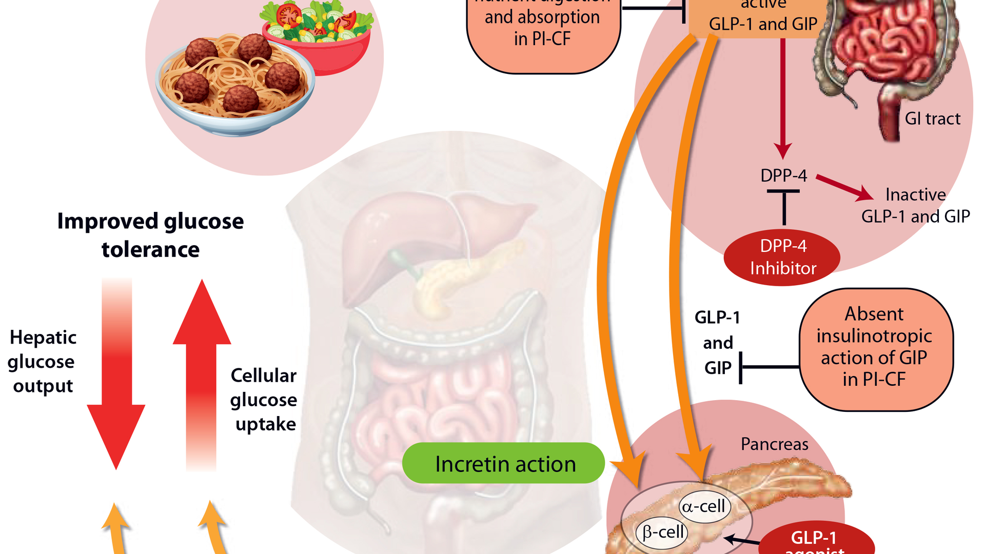 Enrolling trial: GLP-1 agonist therapy in cystic fibrosis | Clinical ...