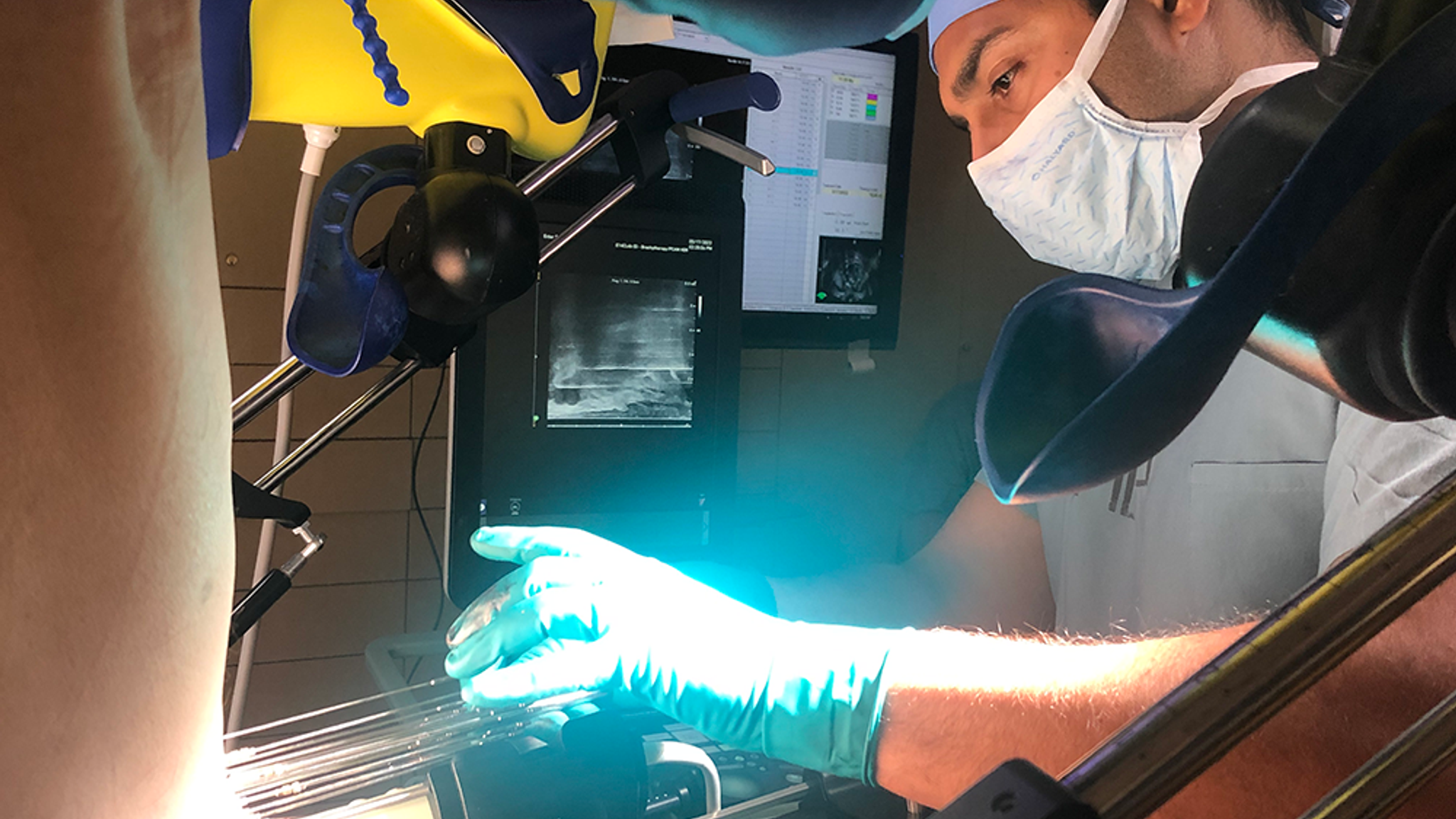 HDR brachytherapy for localized prostate cancer | Clinical Briefing